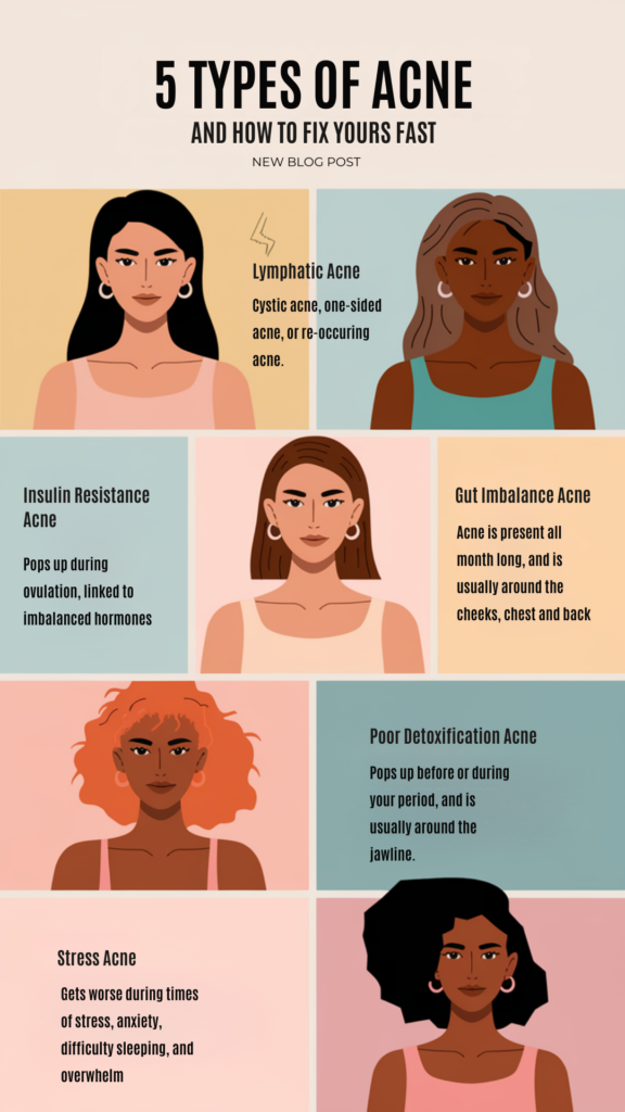 The 5 Types of Acne & How to Fix Yours Fast!
